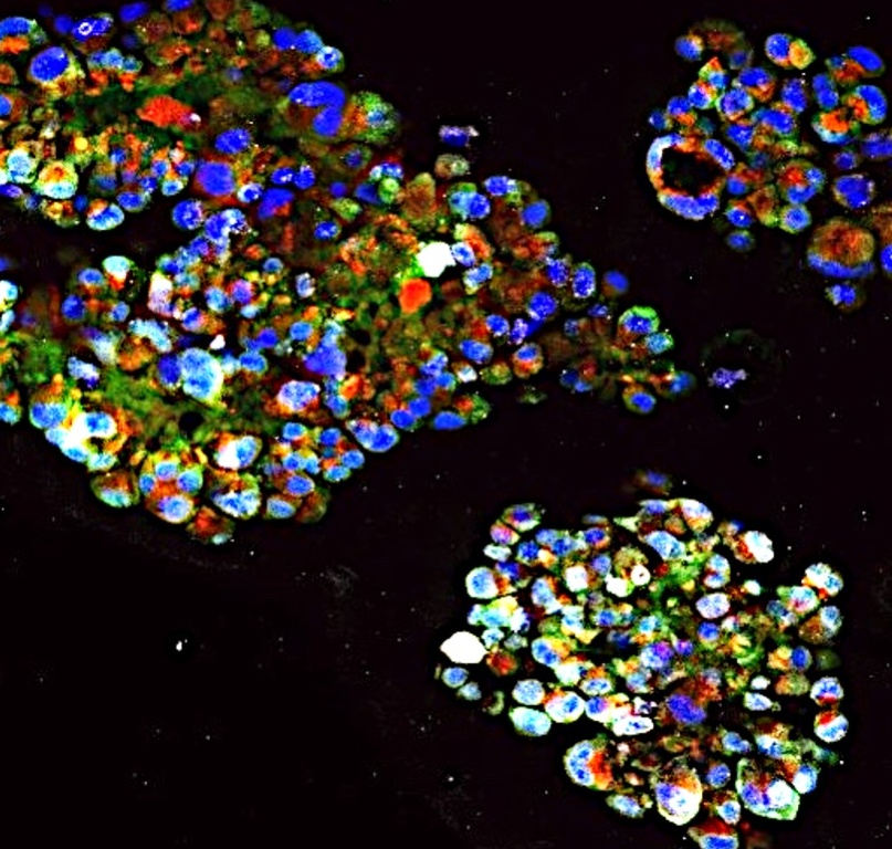 Researchers use mini lung models called organoids to explore how lung ...